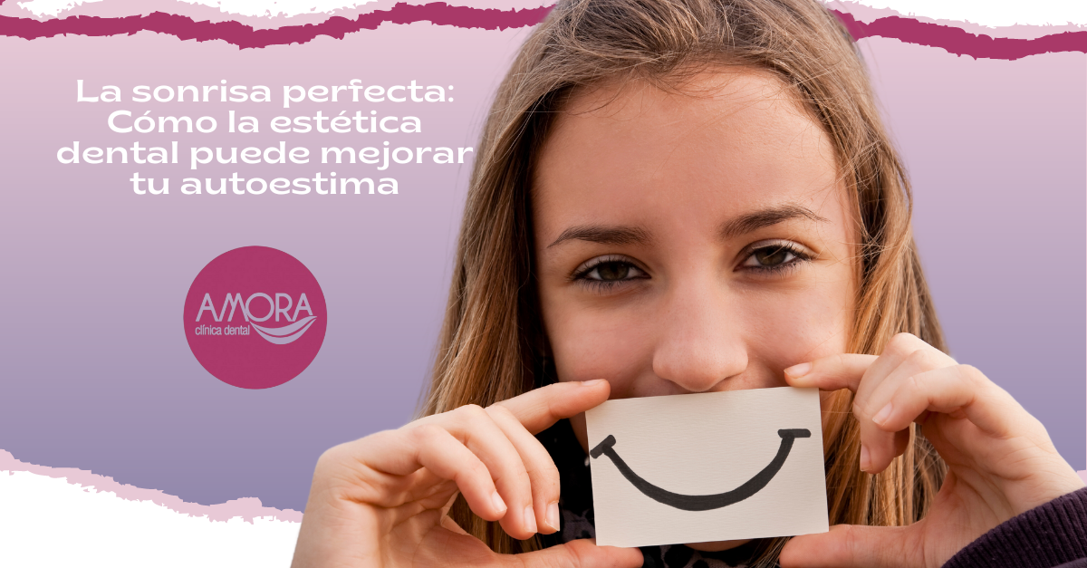 La sonrisa perfecta: cómo la estética dental puede mejorar tu ...